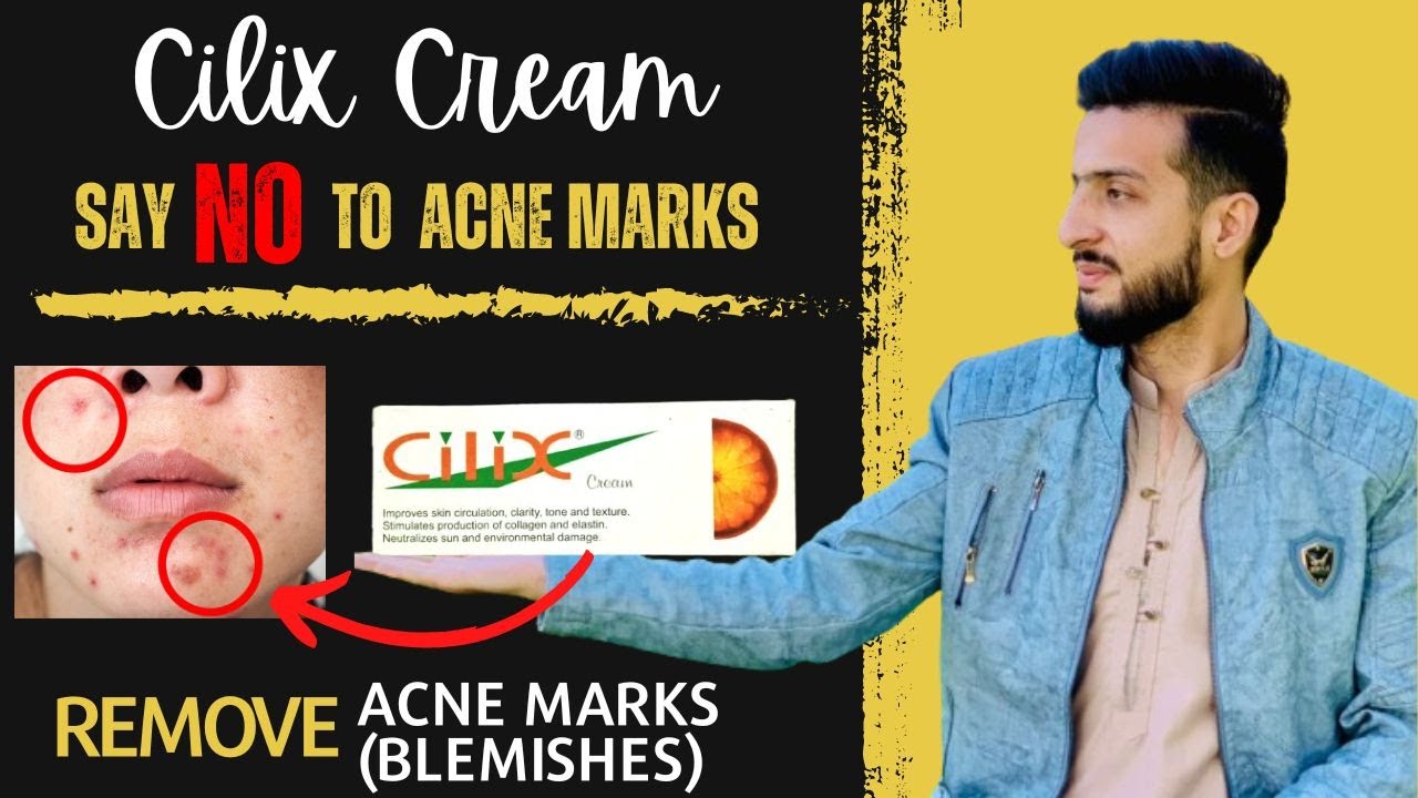Cilix Cream | Get Rid of Acne Marks | Remove Blemishes | Pigmentation ...