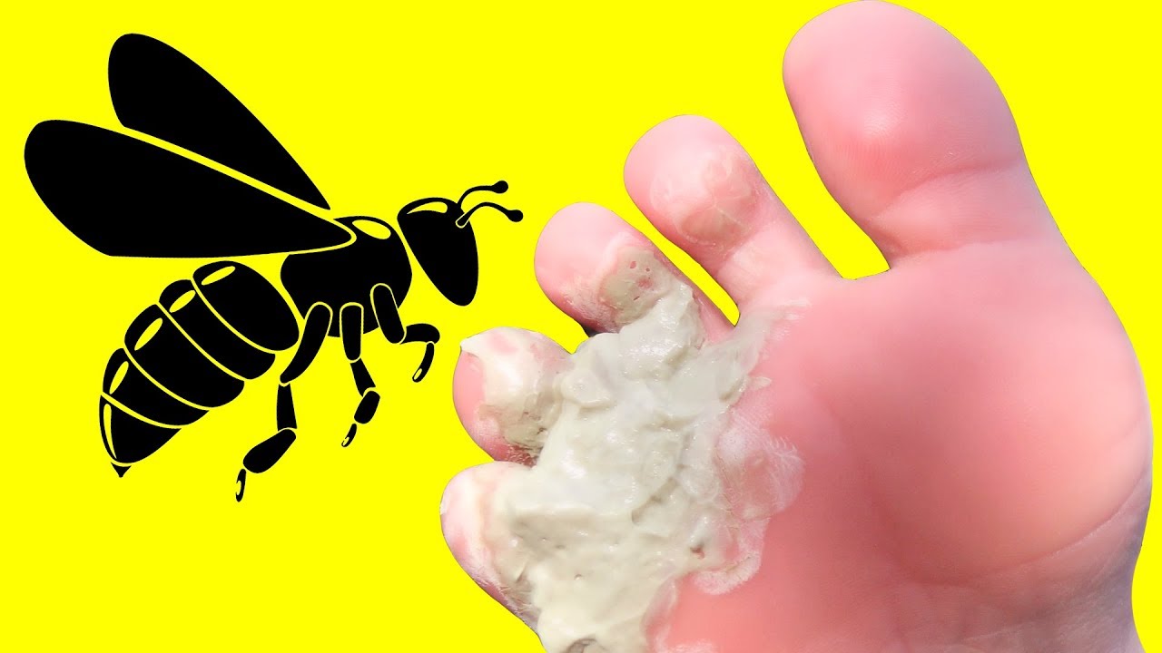 OUCH!! Stung by a Bee - YouTube