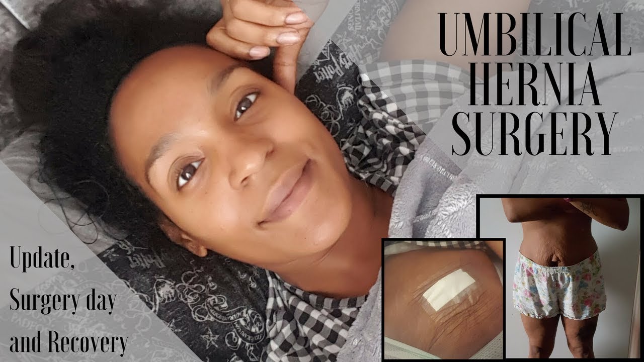 UMBILICAL HERNIA SURGERY UPDATE AND PICTURES YouTube