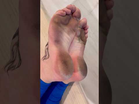 DIRTY FEET! 😱 this is what happens when you walk barefoot thru a public parking garage 👣