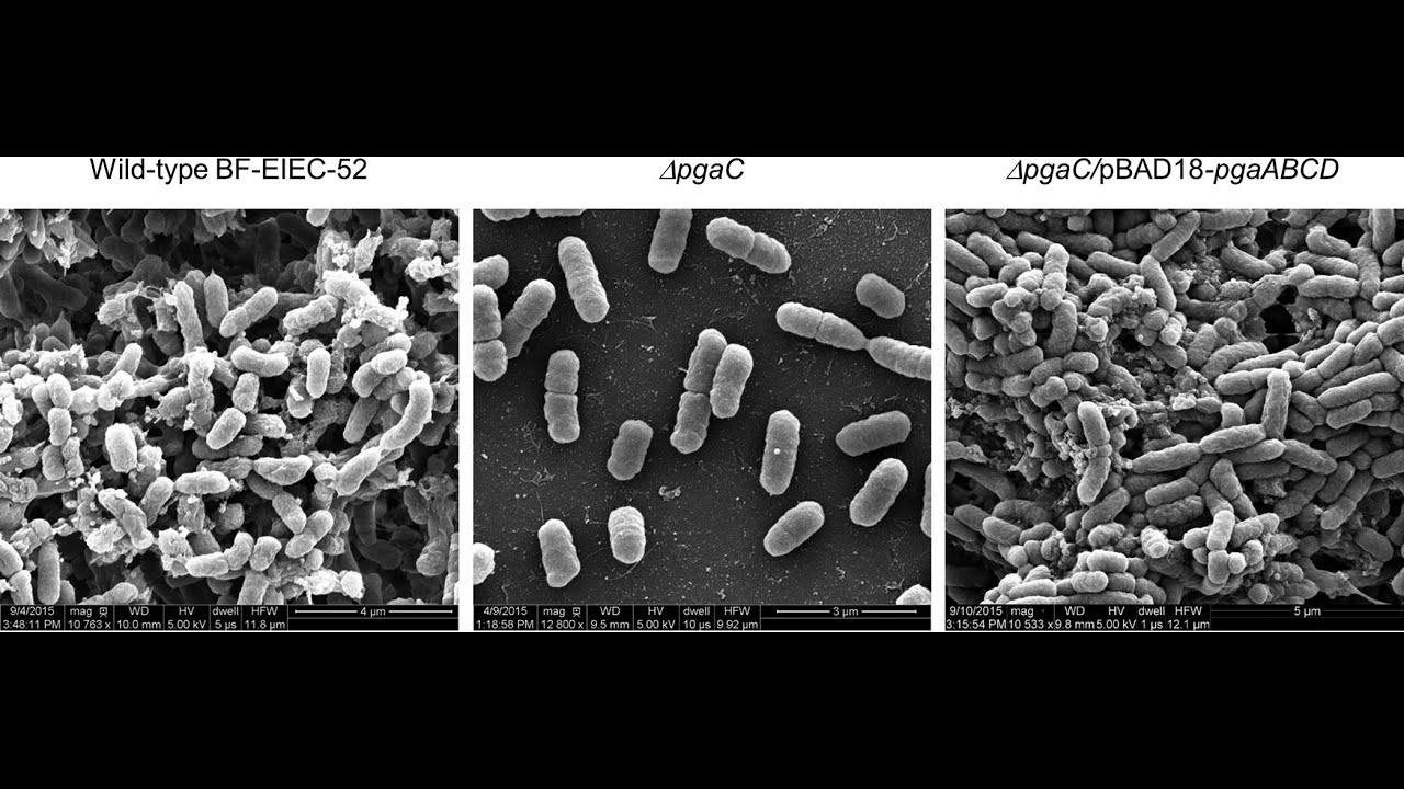 Enteroinvasive Escherichia coli (E Coli) ; Definition, Symptoms ...