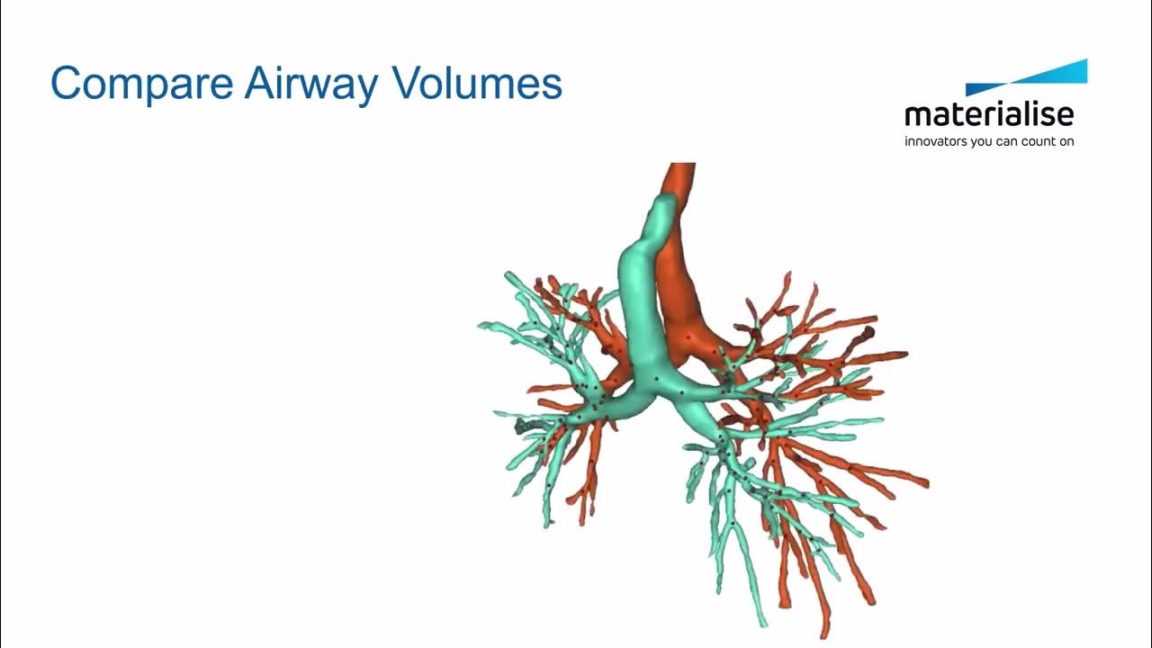 Tutorial: Automatic Pulmonary Segmentation, Design, and Analysis - YouTube