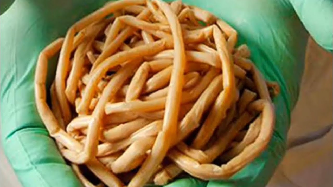 5 ZNAKOVA DA IMATE PARAZITE U TELU! EVO KAKO IH SE REŠITI PRIRODNIM ...