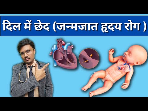 Cyanotic vs Acyanotic congenital heart disease: What Parents Must Know!