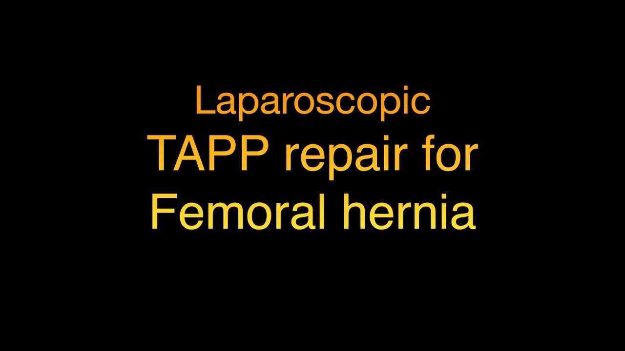3. Laparoscopic TAPP repair for Femoral hernia - Dr.R.Parthasarathi ...