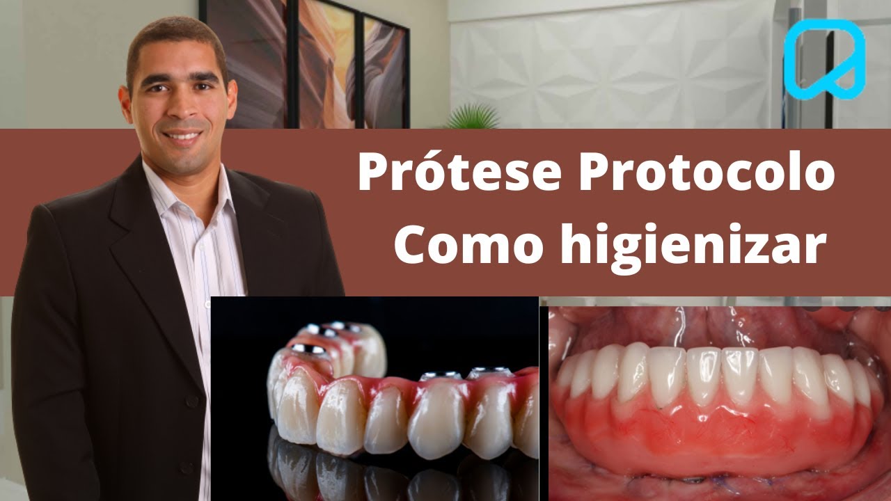 Prótese Protocolo │ Como higienizar. @dr.alexguedes - YouTube