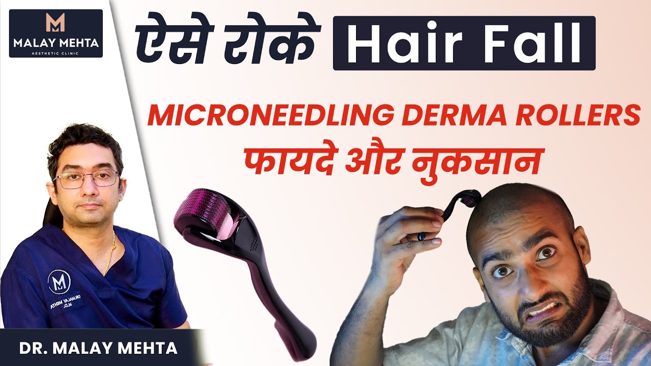 👉Benefits, Side Effects and Complications of 💹Microneedling and Derma ...