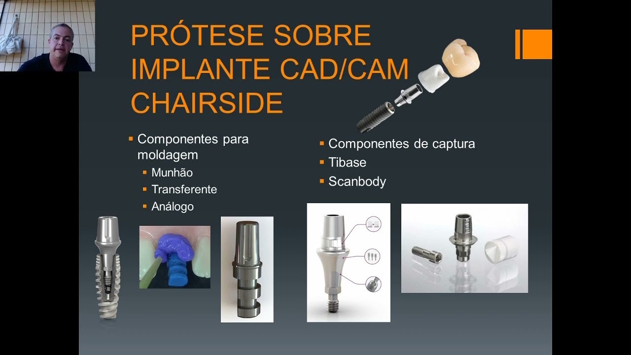 Prótese sobre implante CAD CAM Chairside CEREC - YouTube