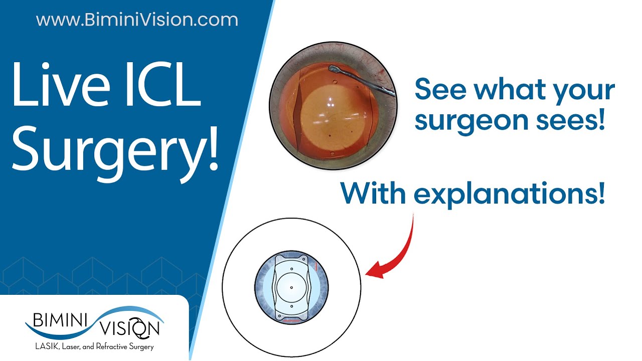 What Does ICL Surgery Look Like? (Your Surgeon's View!) - YouTube