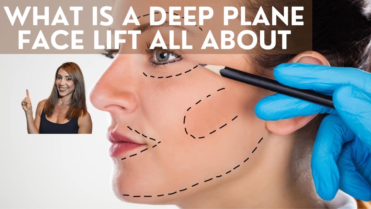 What is a deep plane face lift all about? - YouTube