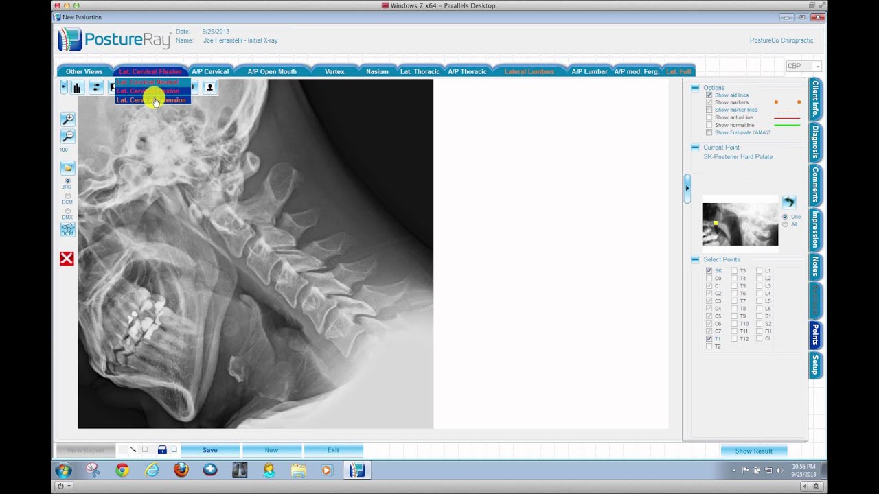 Importing digital x rays - YouTube