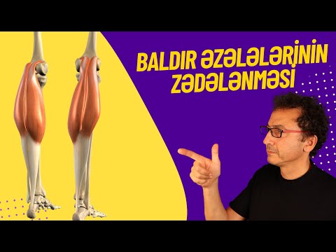 BALDIR ƏZƏLƏLƏRİNİN ZƏDƏLƏNMƏSİ