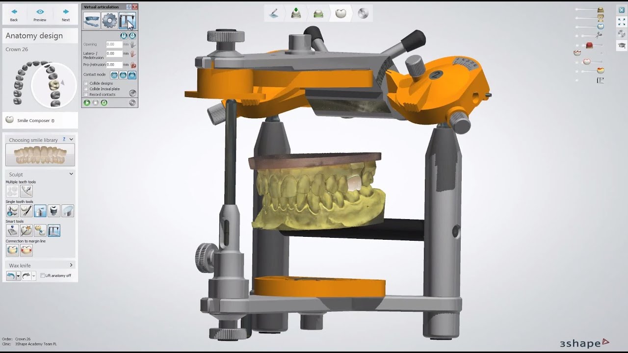 Dynamic Virtual Articulator - YouTube