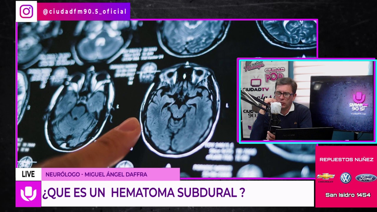 ¿Que es un Hematoma Subdural? - YouTube