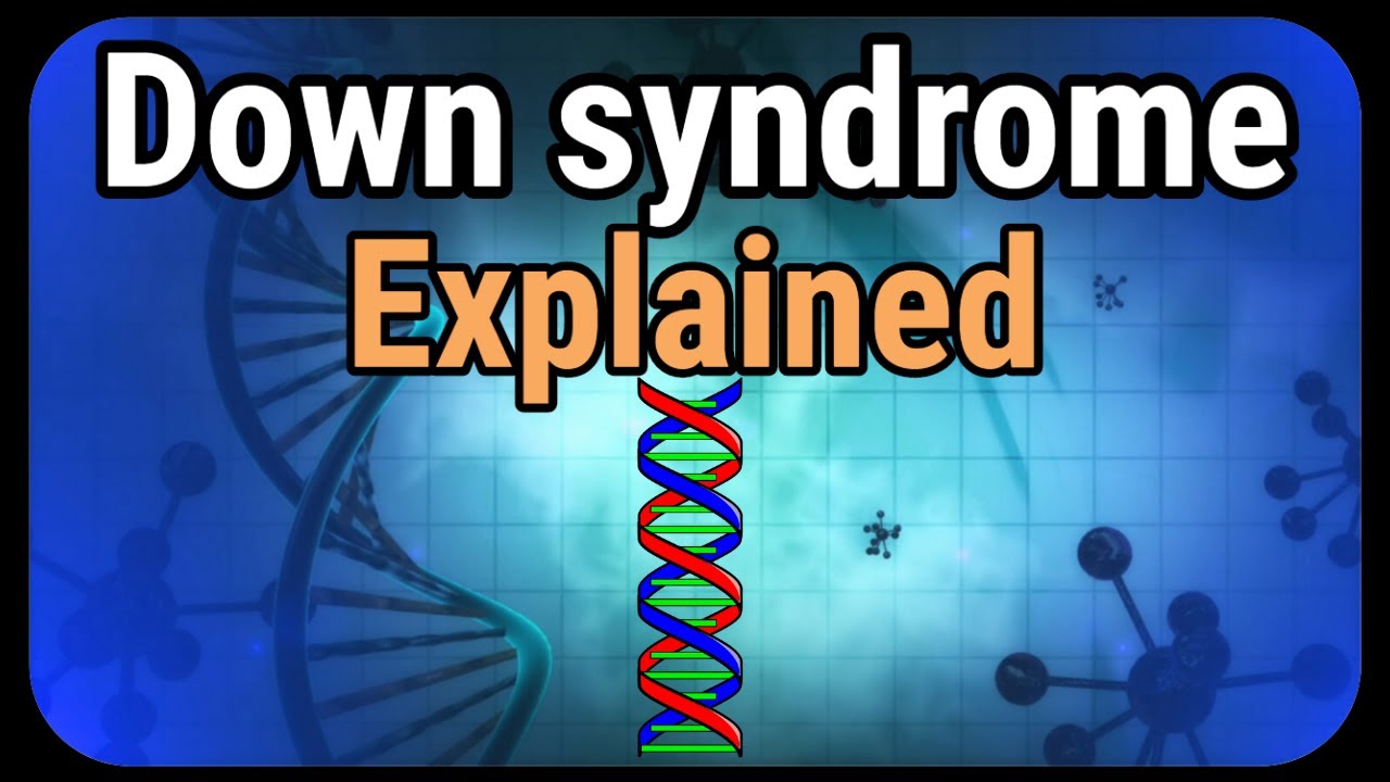 Down syndrome (trisomy 21) explained | What is Down Syndrome? - YouTube