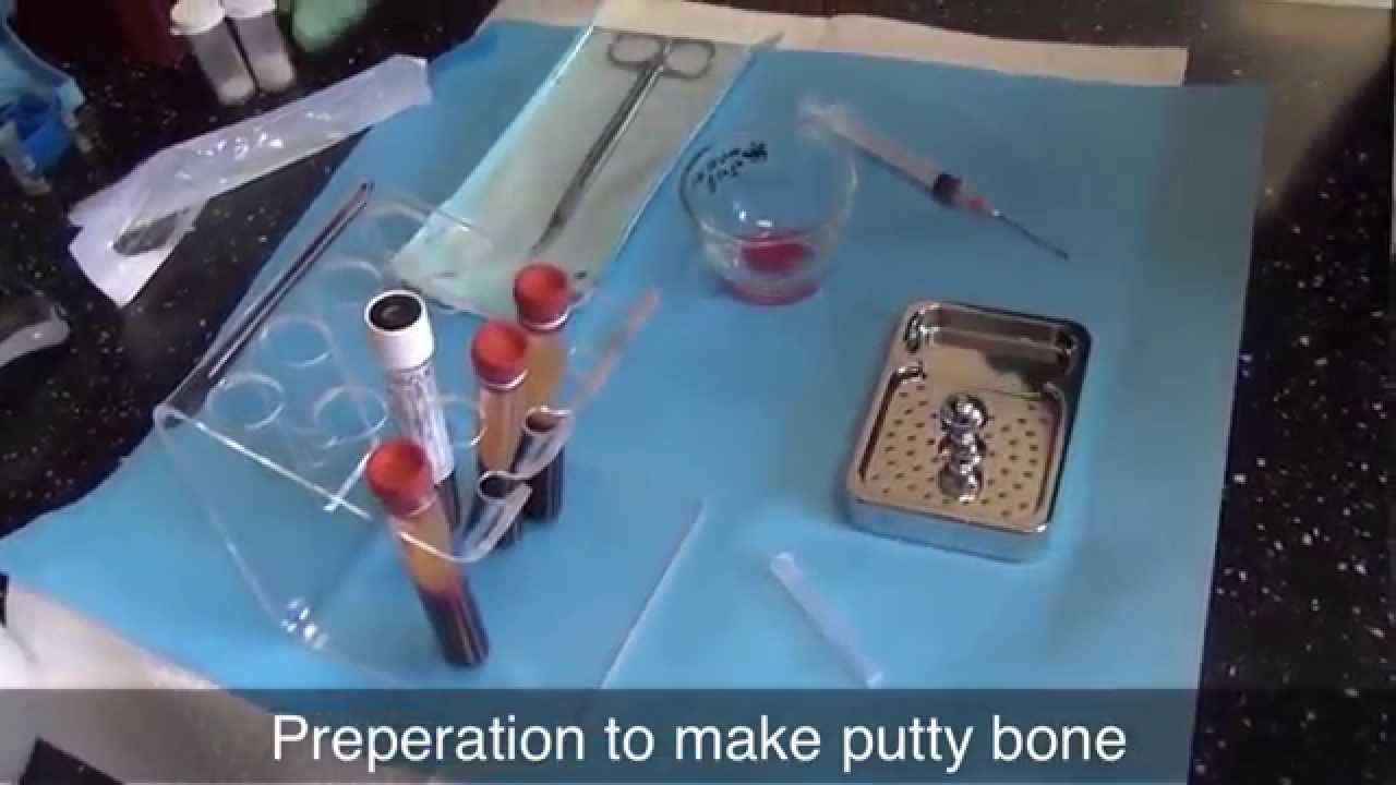 CGF Membrane by Dr. Daniel Kim - YouTube