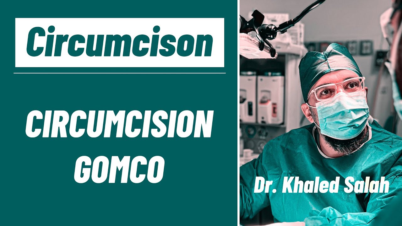Circumcision with GOMCO الطهارة الختان باستخدام جومكو - YouTube