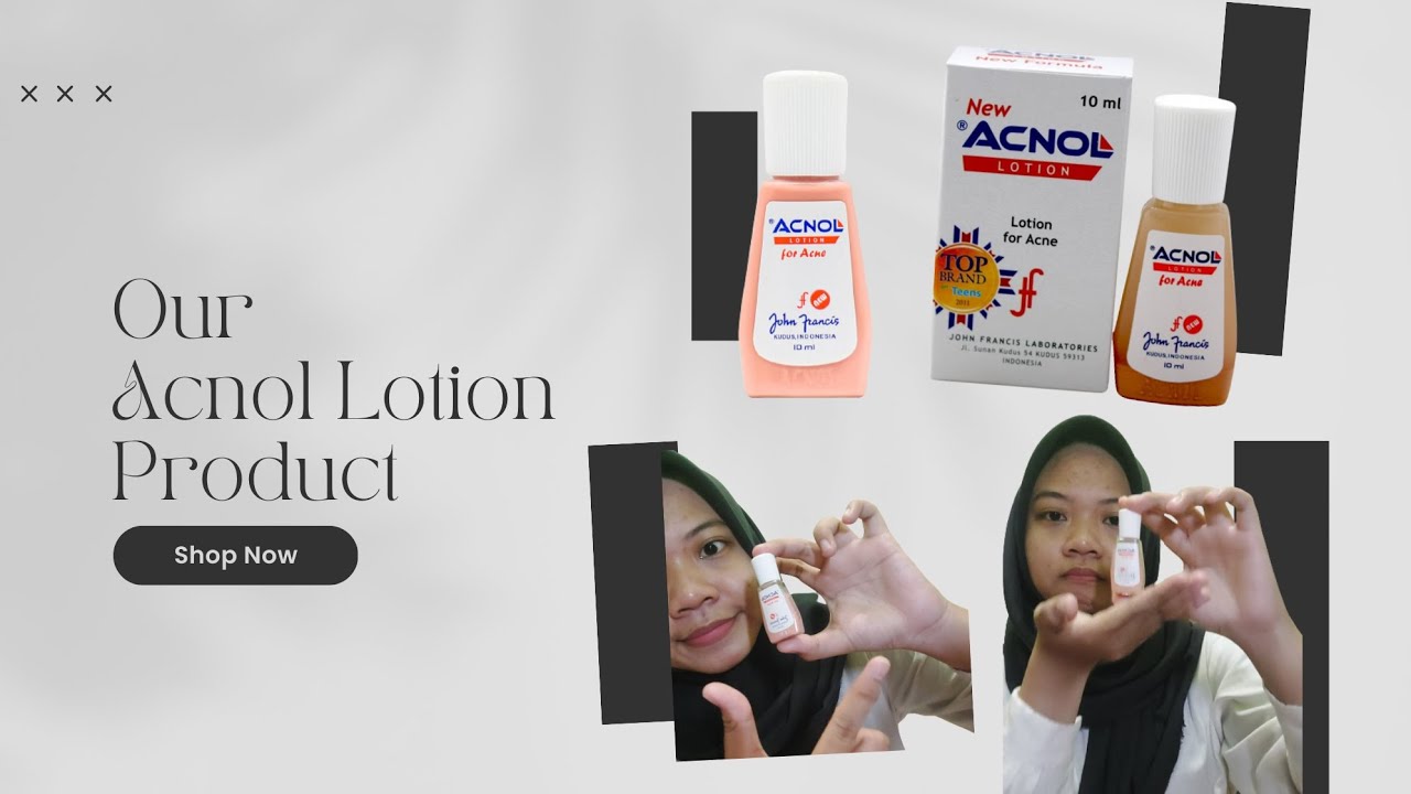 Practice of Promoting Acnol Lotion for acne removal by Elsyafa Azizun ...