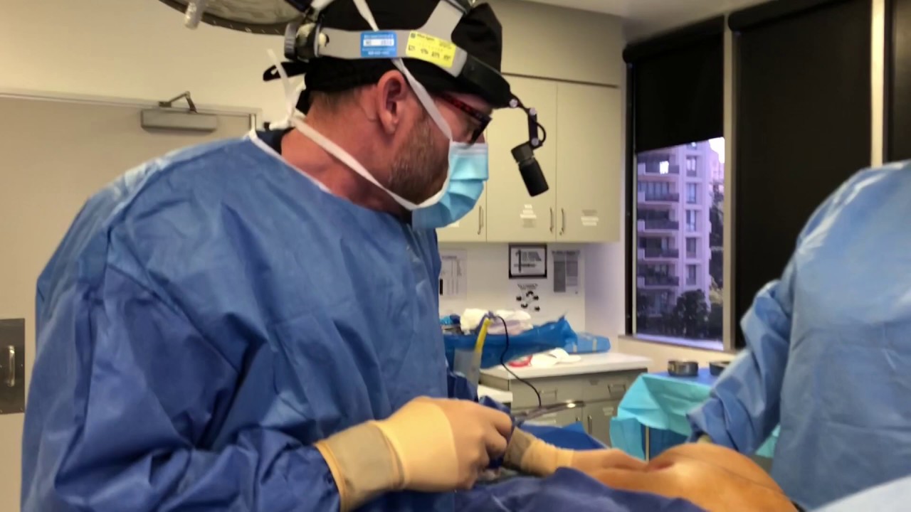 Making The Switch From Round to Stanton Anatomic Buttock Implants - YouTube