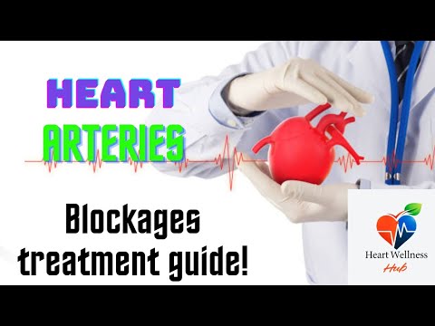 Unblocking the Heart: A Comprehensive Guide to Treating Artery Blockage ...
