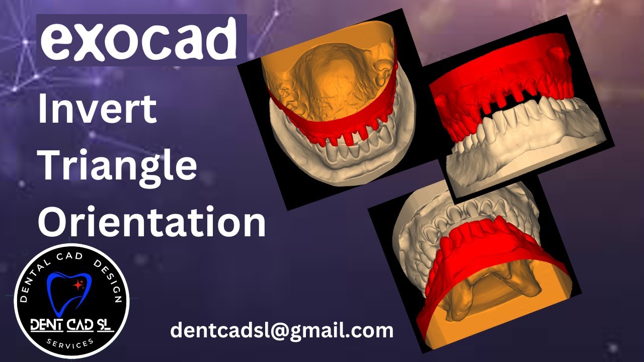 change triangle orientation in exocad - YouTube