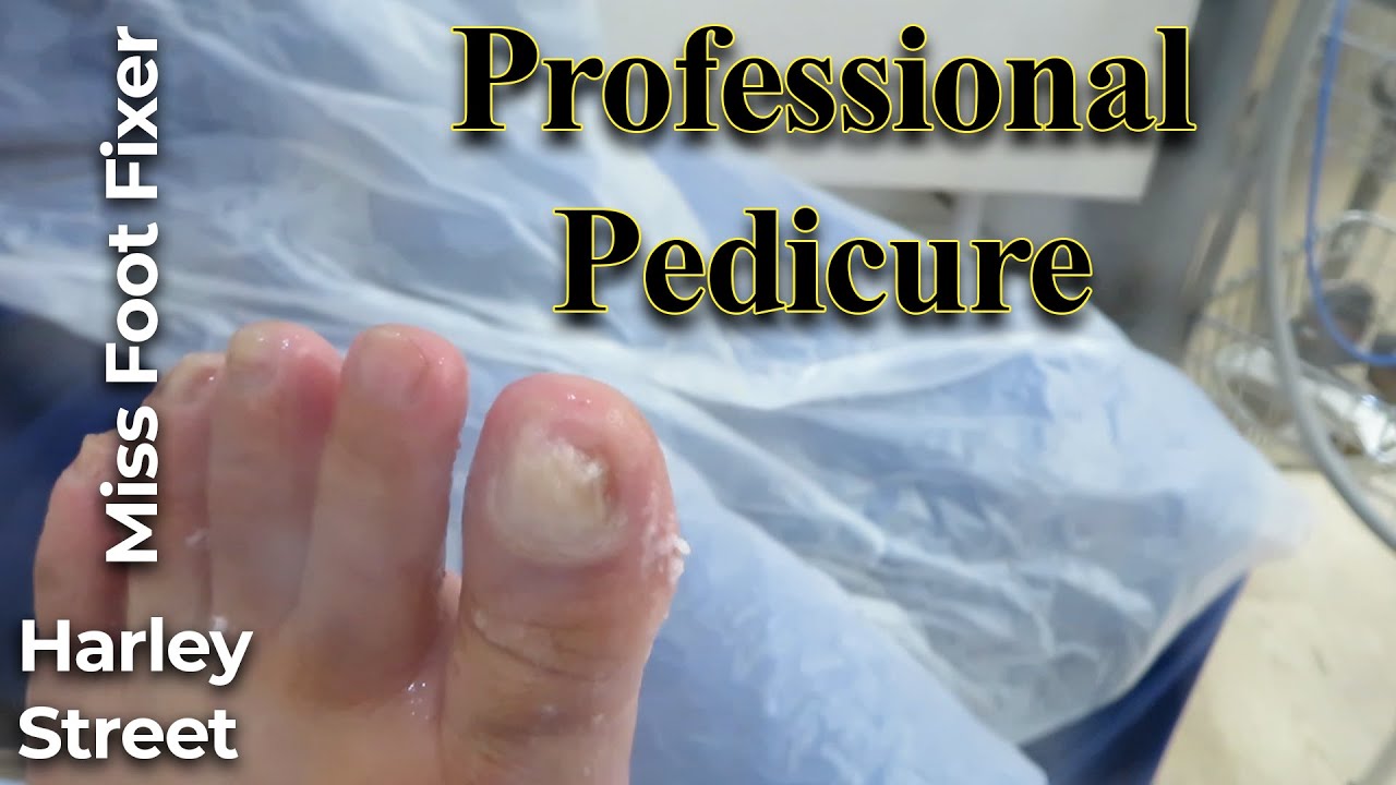 No More long nail and callus By Miss Foot Fixer Marion Yau - YouTube