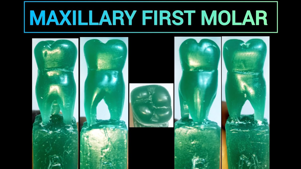 Carving Of Maxillary First molar || STEP BY STEP || Carving Tutorial # ...