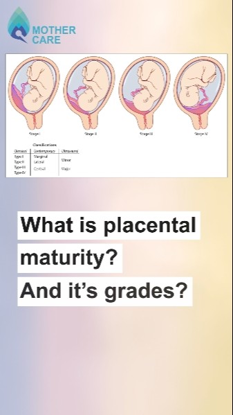What is Placenta Maturity? | Dr Supriya Puranik #mothercare # ...