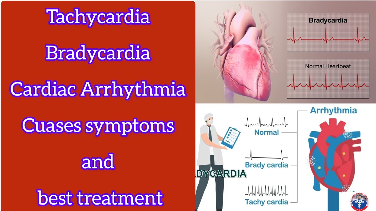 Tachycardia|Bradycardia|Cardiac Arrhythmia Cuases symptoms and best ...