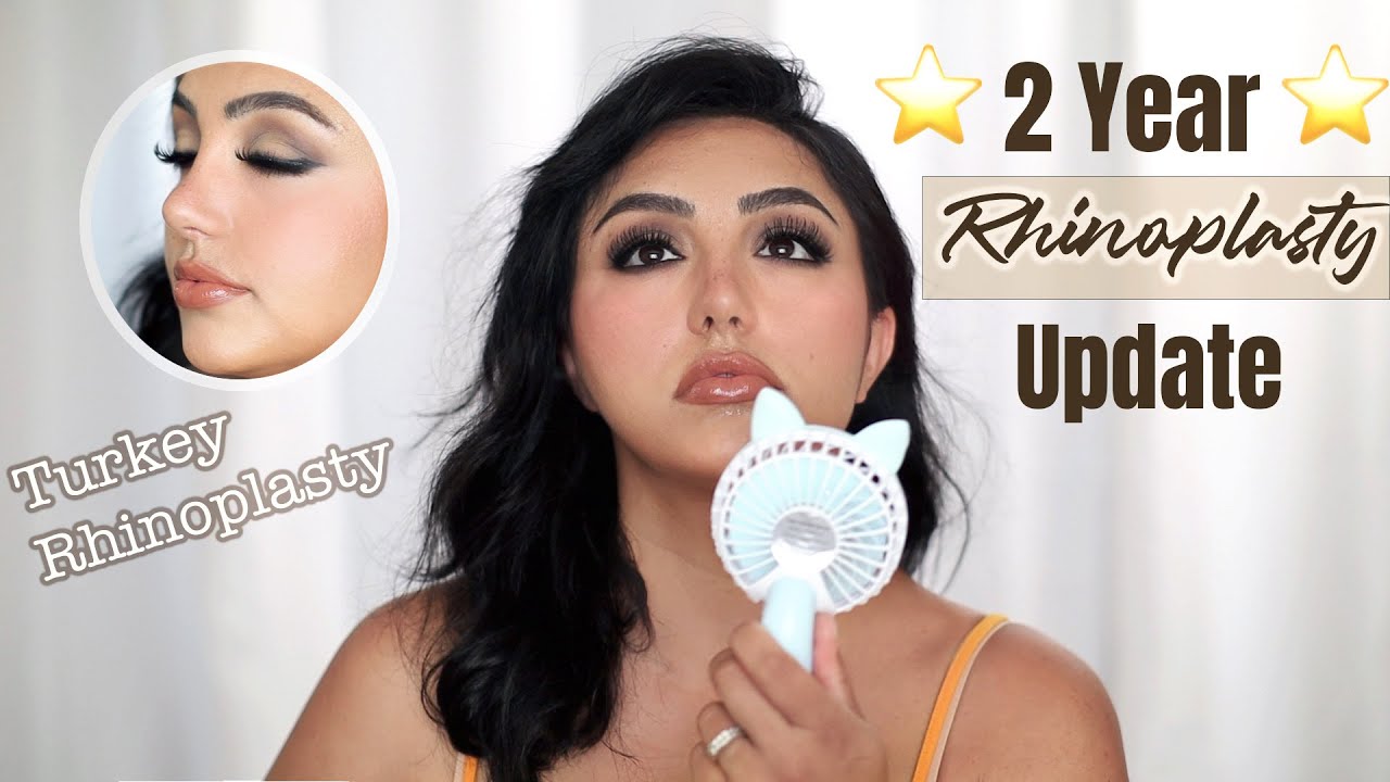 *2 years AFTER RHINOPLASTY* | Dr Resit Burak Kayan patient | Turkey Rhinoplasty update - YouTube