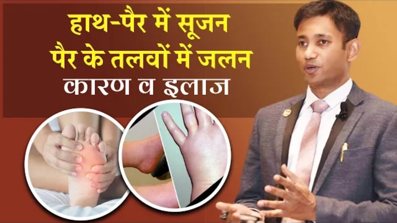 Hath Pair Me Sujan Ka ilaj | Pair Ke Talvo Me Jalan ka Ilaj | Dr ...