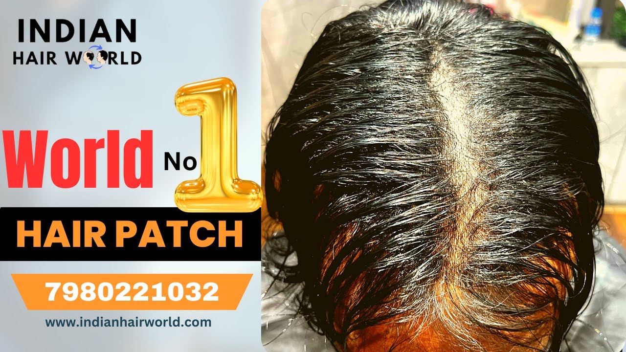 Hair Patch in Kolkata: Revolutionize Your Look with the World's No. 1 ...