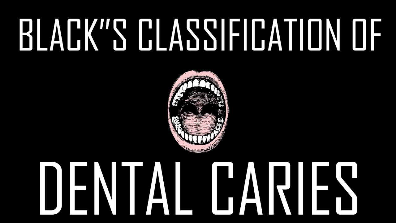 4- Black's Classification of Dental Caries - YouTube