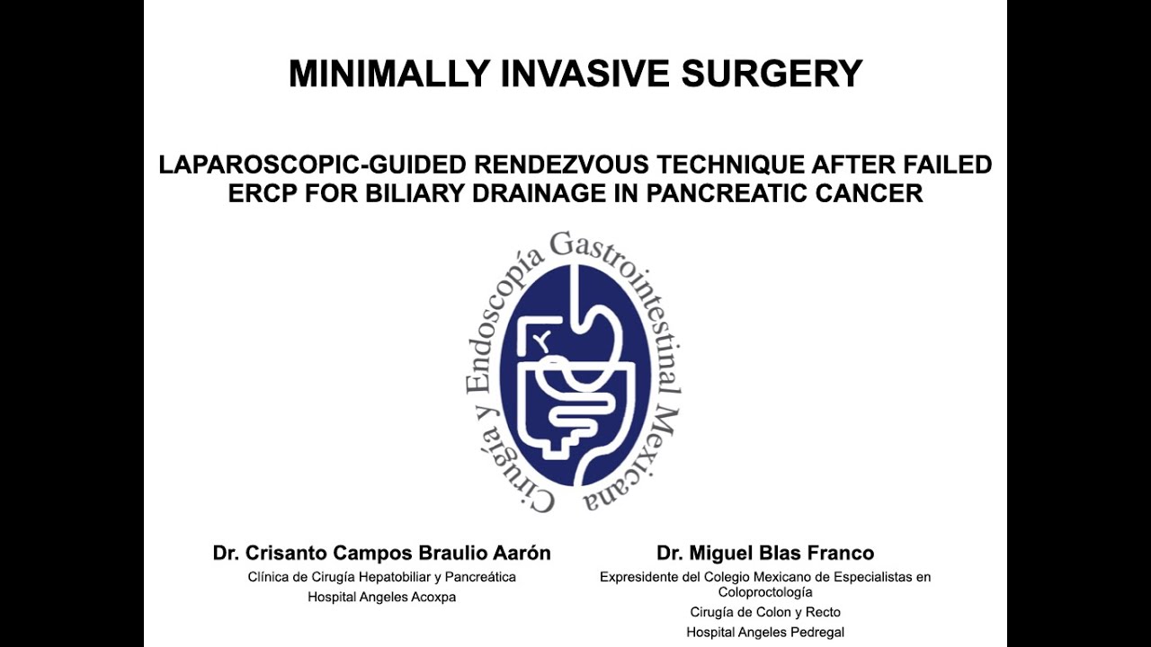 Laparoscopic-Guided Rendezvous Technique after Failed ERCP for Biliary ...