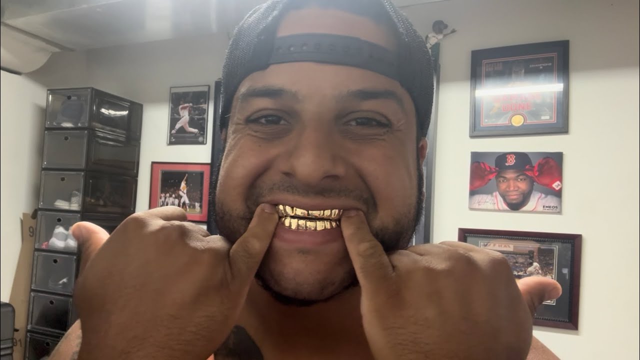 14K Gold Grillz by Johnny Dang | process from start to finish 10on10 ...
