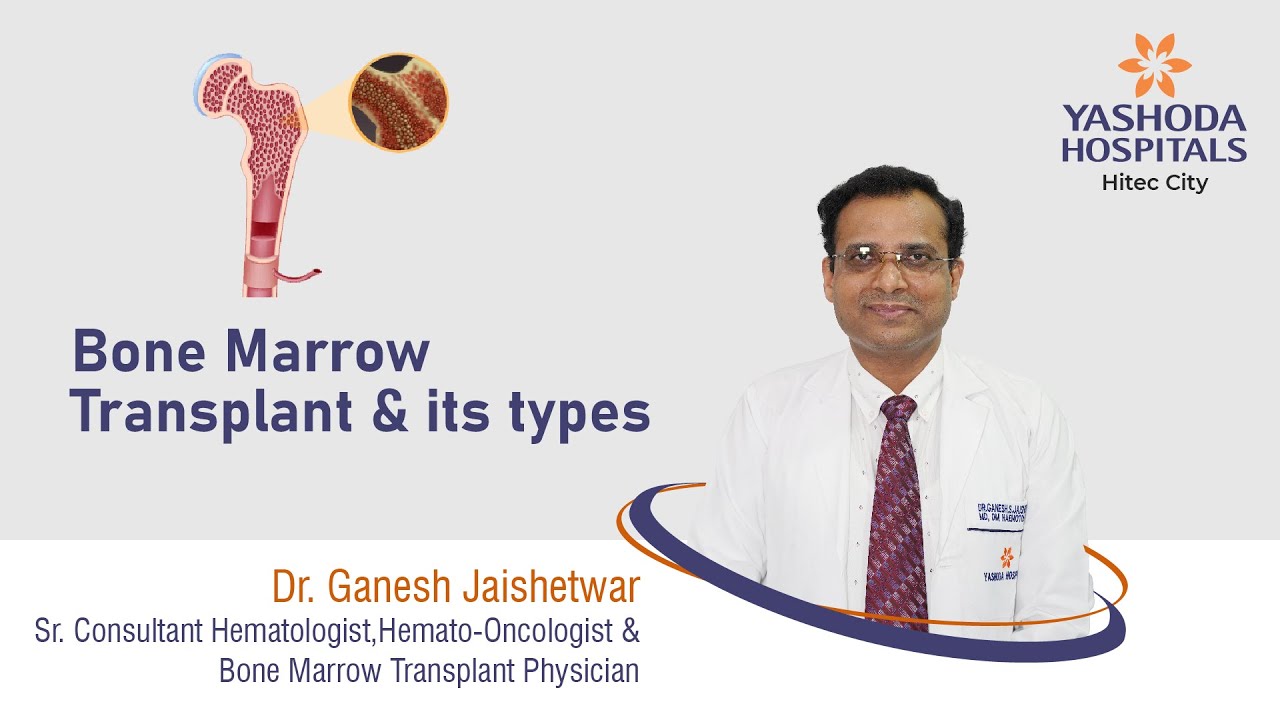 Bone Marrow Transplant & Its Types Explained | Yashoda Hospitals ...