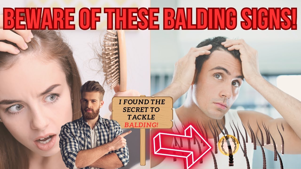 I Prevented Hair Loss: BALDING Signs You Can't Ignore! - YouTube