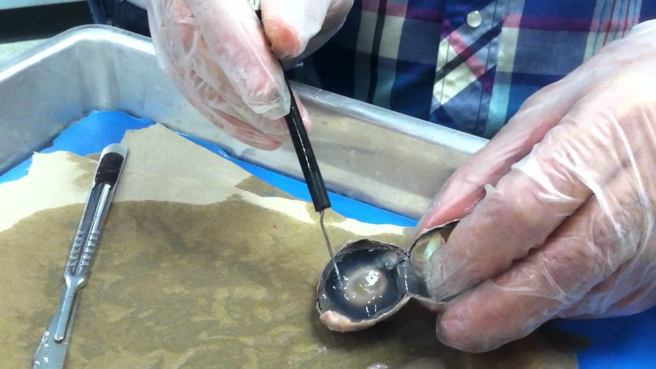 Dr. Reed's A&P 2 Eye Dissection - YouTube