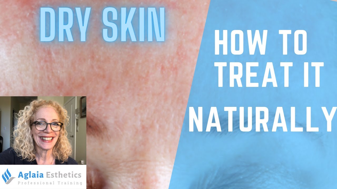 DRY SKIN | HOW TO TREAT IT | NATURALLY! - YouTube