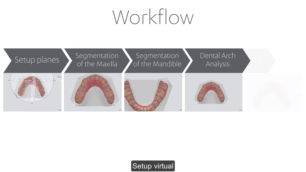 Clear Aligner Studio Workflow BR PT - YouTube