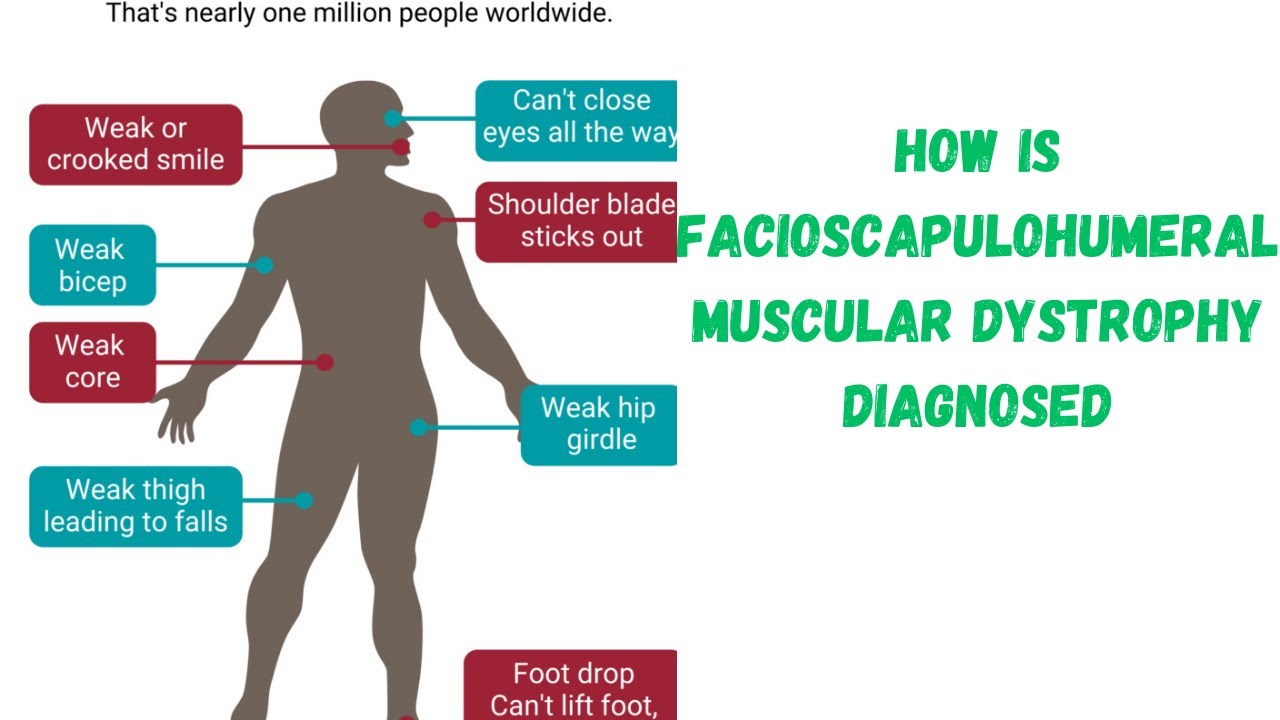 How is Facioscapulohumeral muscular dystrophy diagnosed? - YouTube