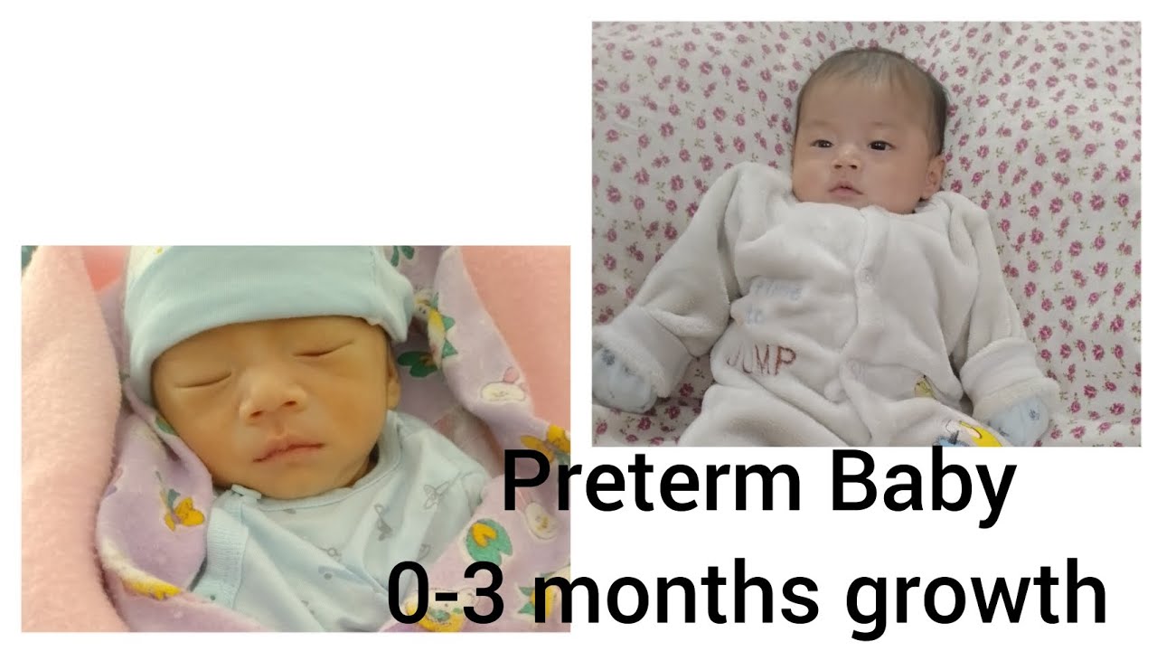 Preterm Baby growth from 0 - 3 monthsll 34 weeksll Newborn baby ll ...