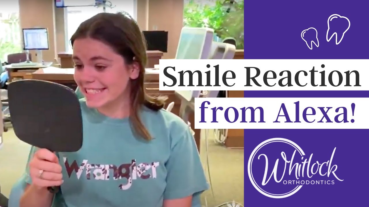 *NEW SMILE ALERT* | Alexa Gets Her DREAM Smile! | Braces for Teens and ...