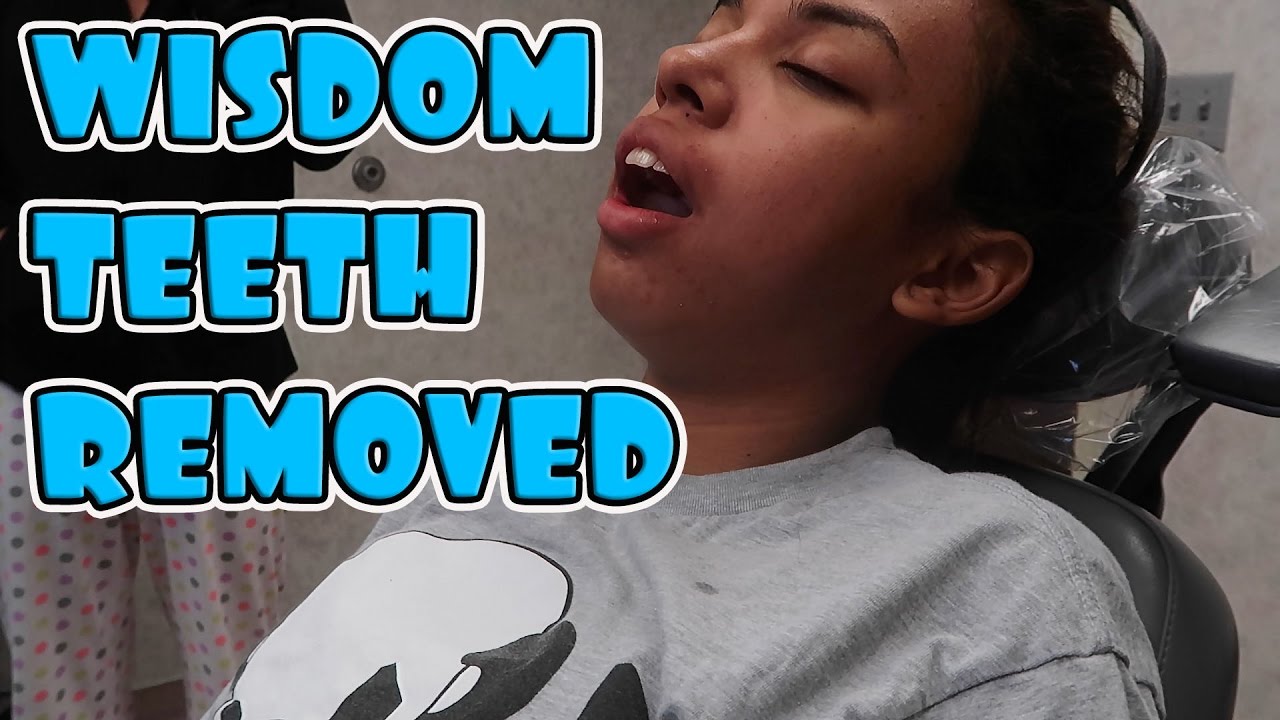 FUNNY WISDOM TEETH REMOVAL - YouTube
