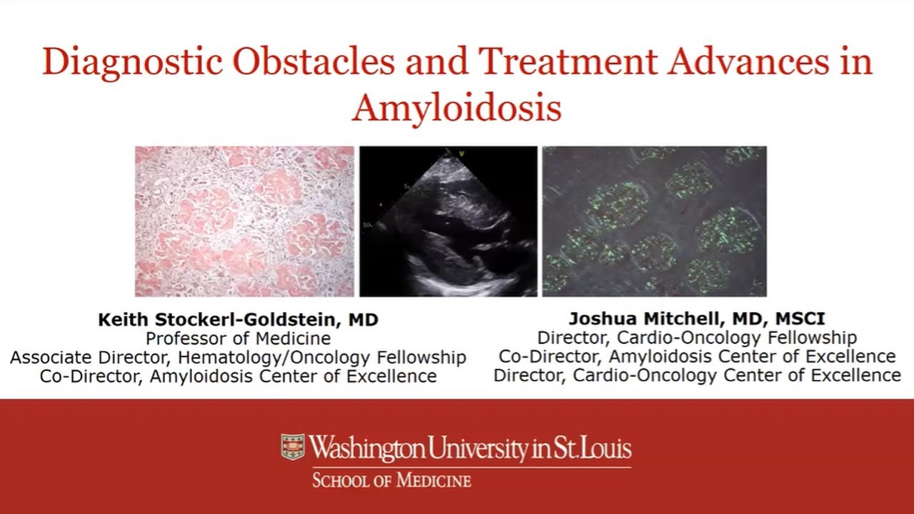 1-19-2023 - Diagnostic Obstacles and Treatment Advances in Amyloidosis ...