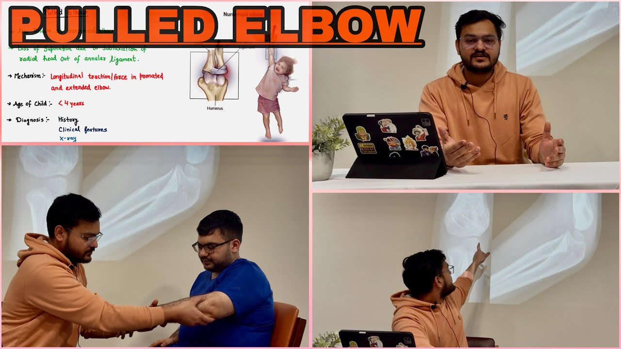 PULLED ELBOW - YouTube