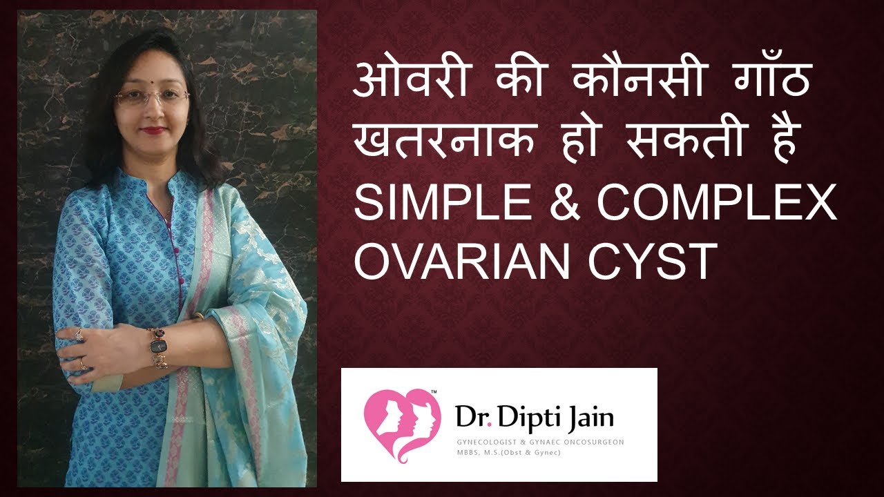 OVARIAN CYST - SIMPLE & COMPLEX ओवरी की गाँठ Which one is dangerous ...