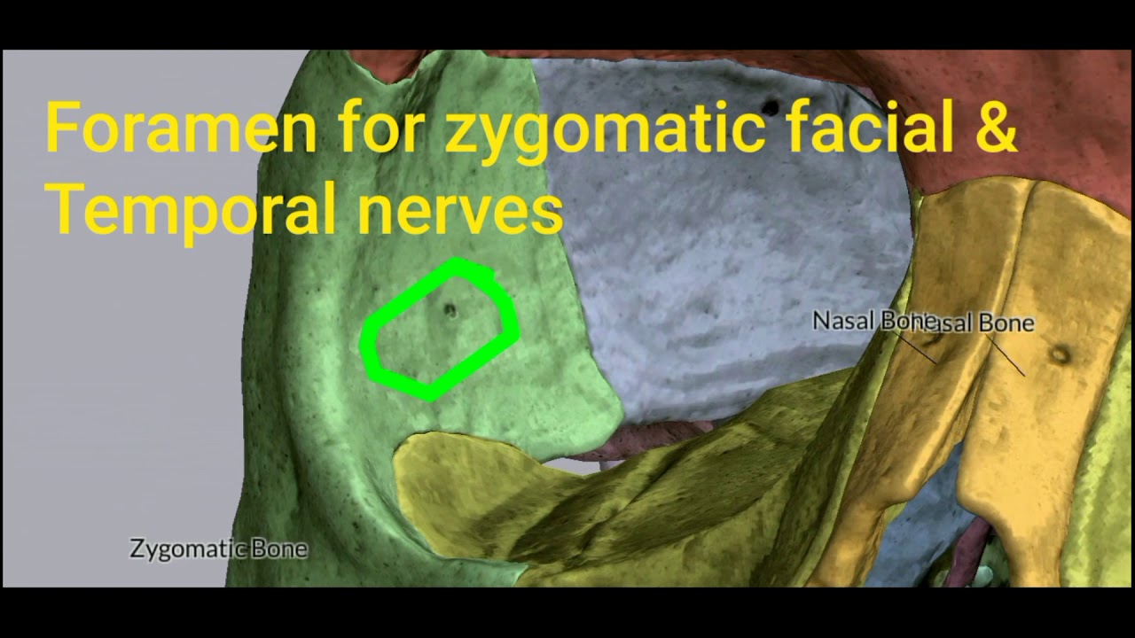 Bones of the Skull - Anatomy of Orbit made easy ( Boundaries & contents ...