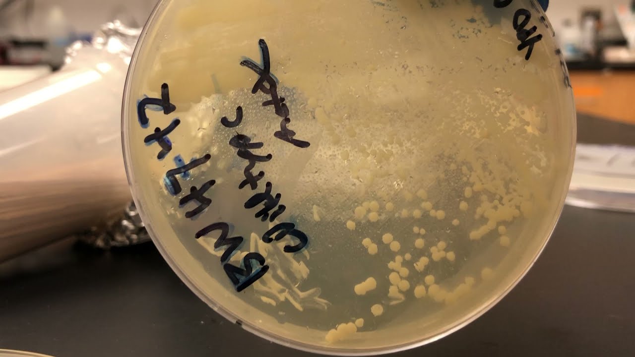 patching and streaking yeast strains - YouTube