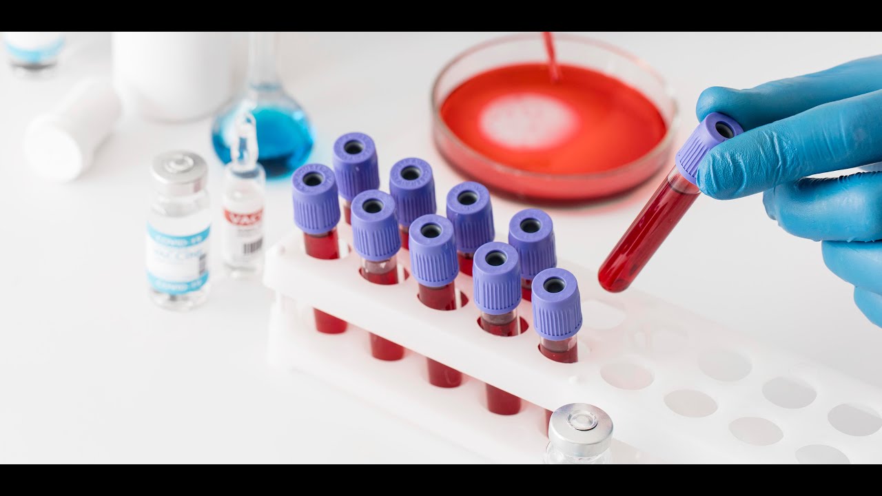 Blood Group Determination in Urdu | Blood Group Test | Blood Group ...